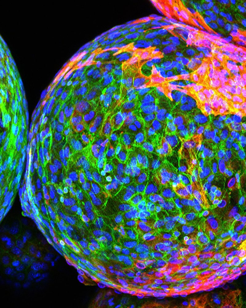 CAMP4 Therapeutics (CAMP) is Game-Changer in RNA-Driven Drug Discovery ...