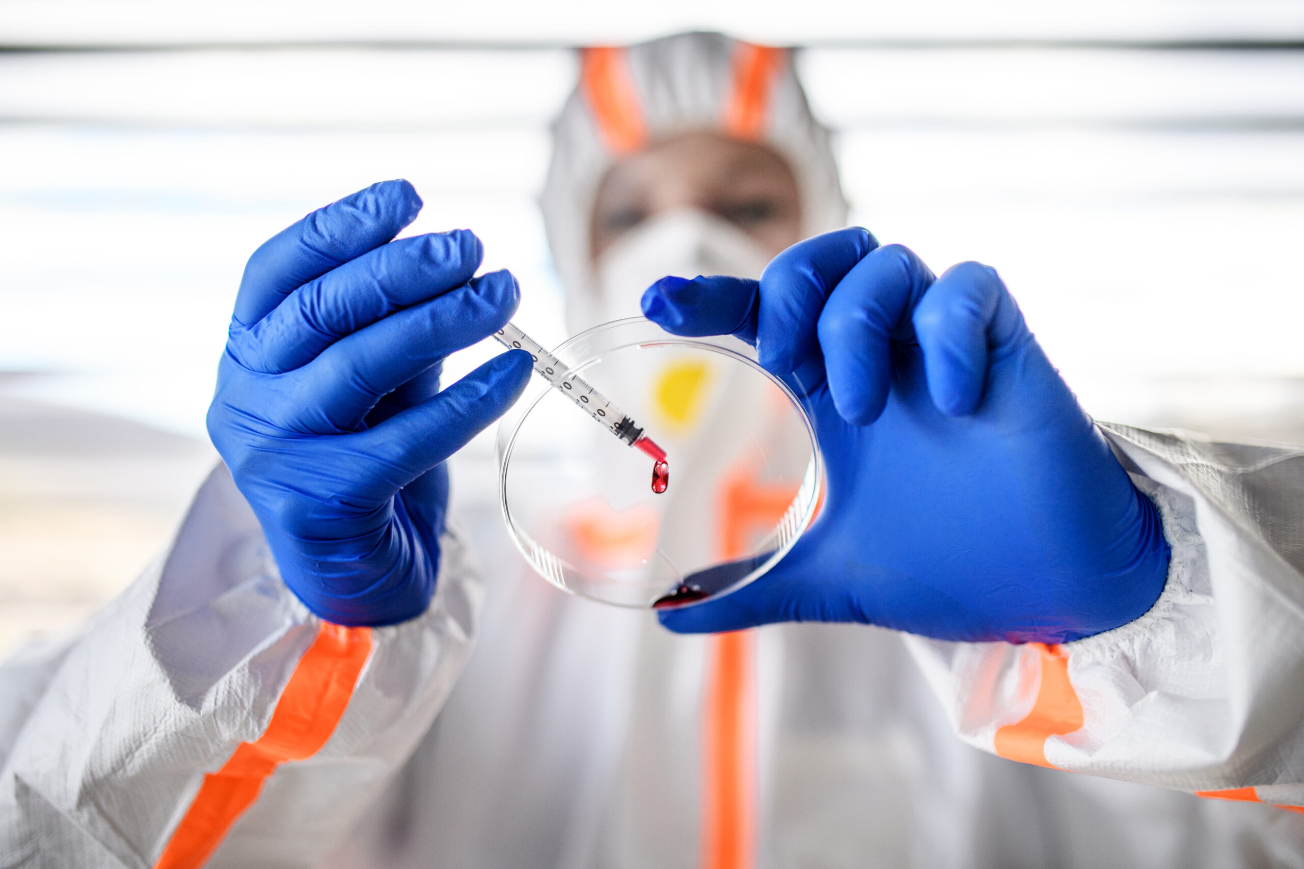 Sensus Healthcare (SRTS) can be the Next 5X Medical Device Stock ...
