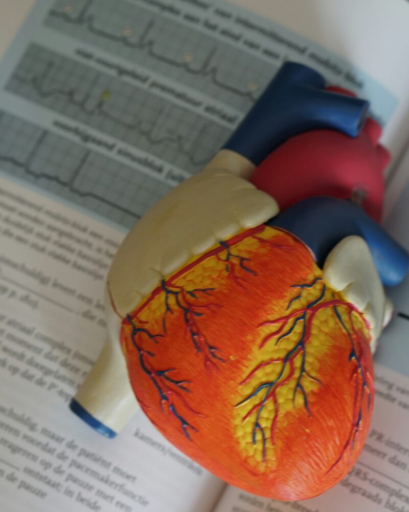 Agios (AGIO) Could Explode in 2025—And It’s Not Just Hype • BioTech ...