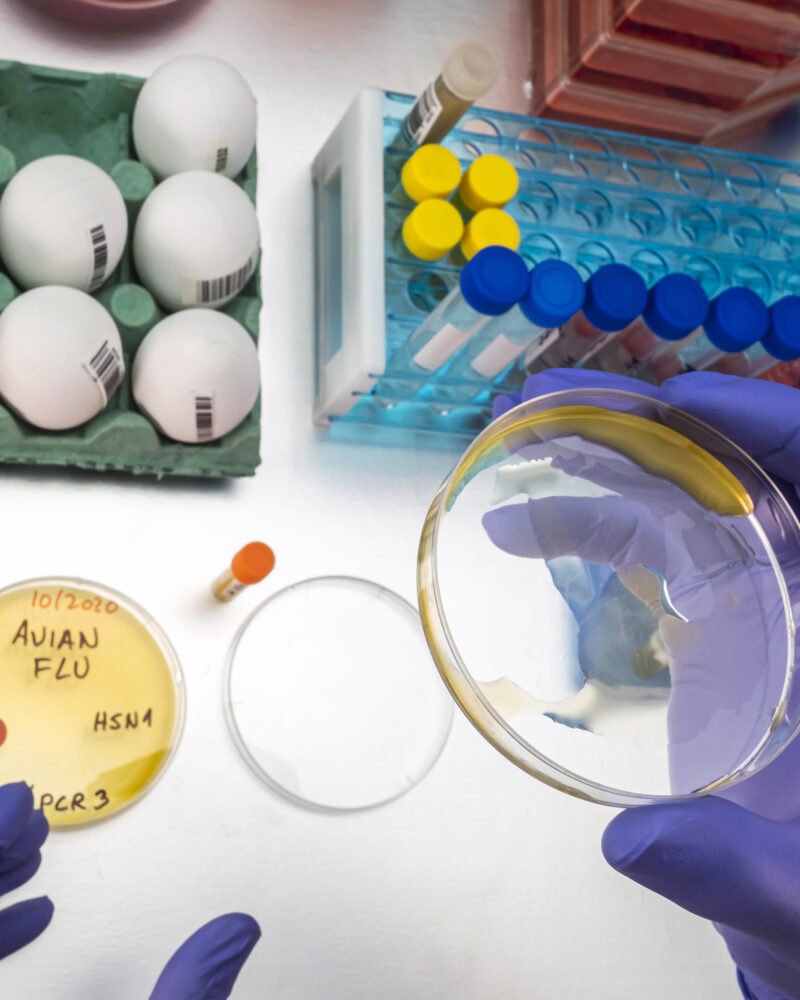 Why EDAP TMS (EDAP) Could Be the Next $2B MedTech Breakout • BioTech ...