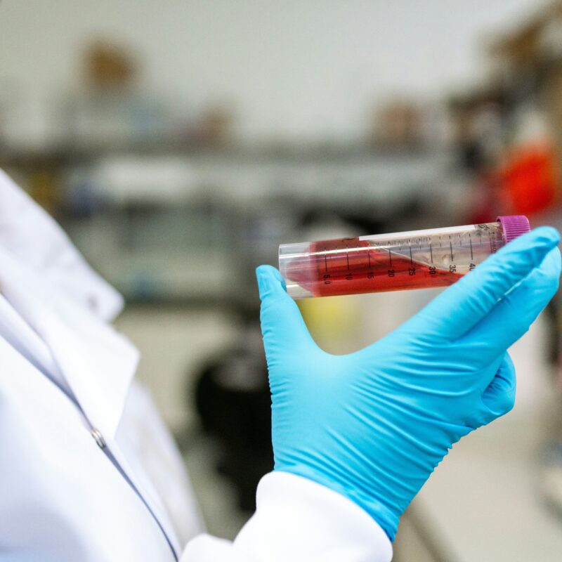 Agios (AGIO) Could Explode in 2025—And It’s Not Just Hype • BioTech ...