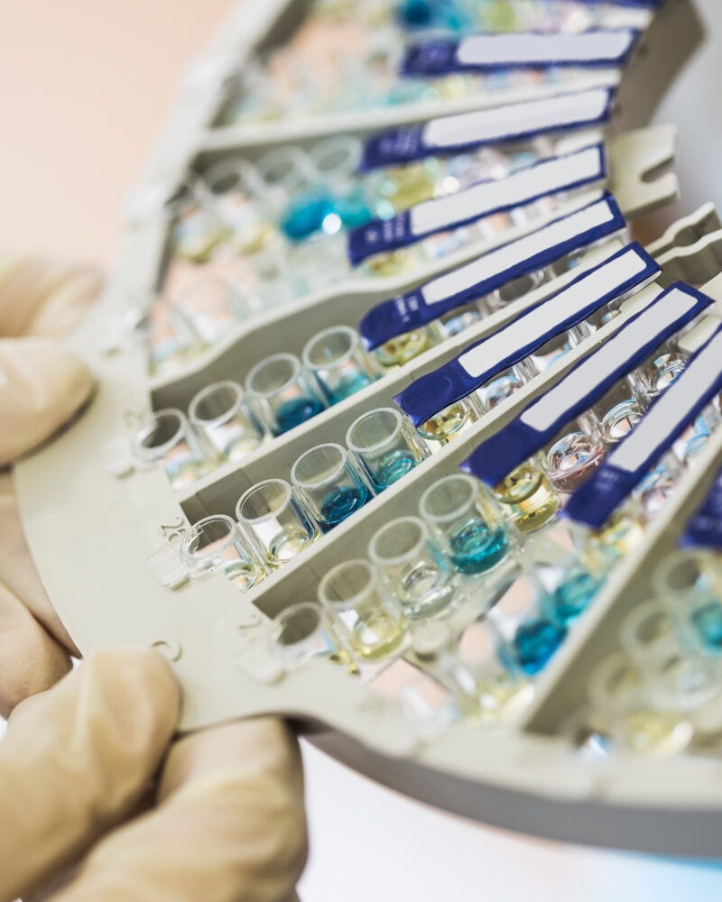 Could Alnylam Pharmaceuticals (ALNY) Be a Smart Long-Term Buy in ...