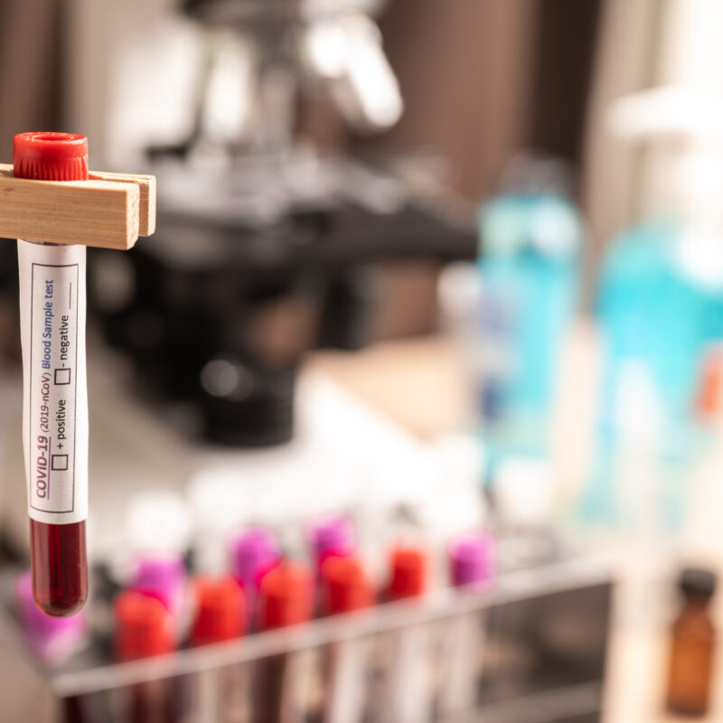 Capricor (CAPR) Emerges as a Top Buyout Target After Breakthrough ...