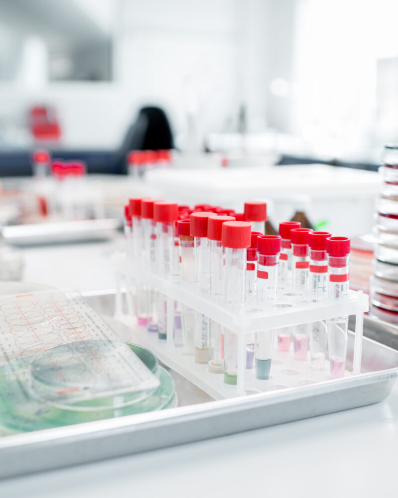 Corvus Pharmaceuticals (CRVS) Net Loss Doubles to $8M in Q2 2025 ...