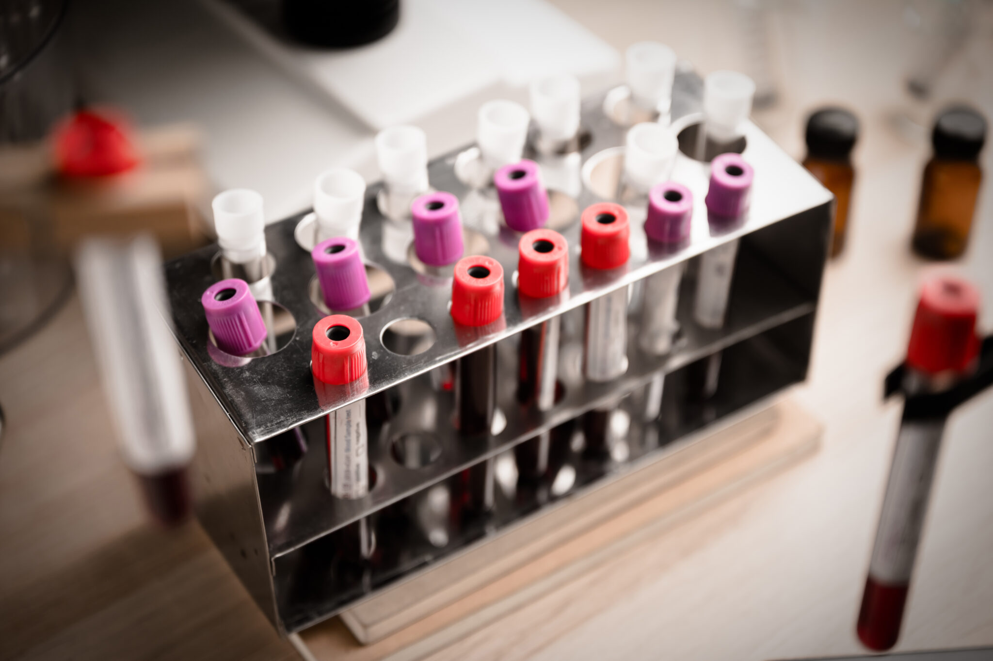 Apyx Medical (APYX) Surges 15% After Record Q3 Revenue of $12.9M ...