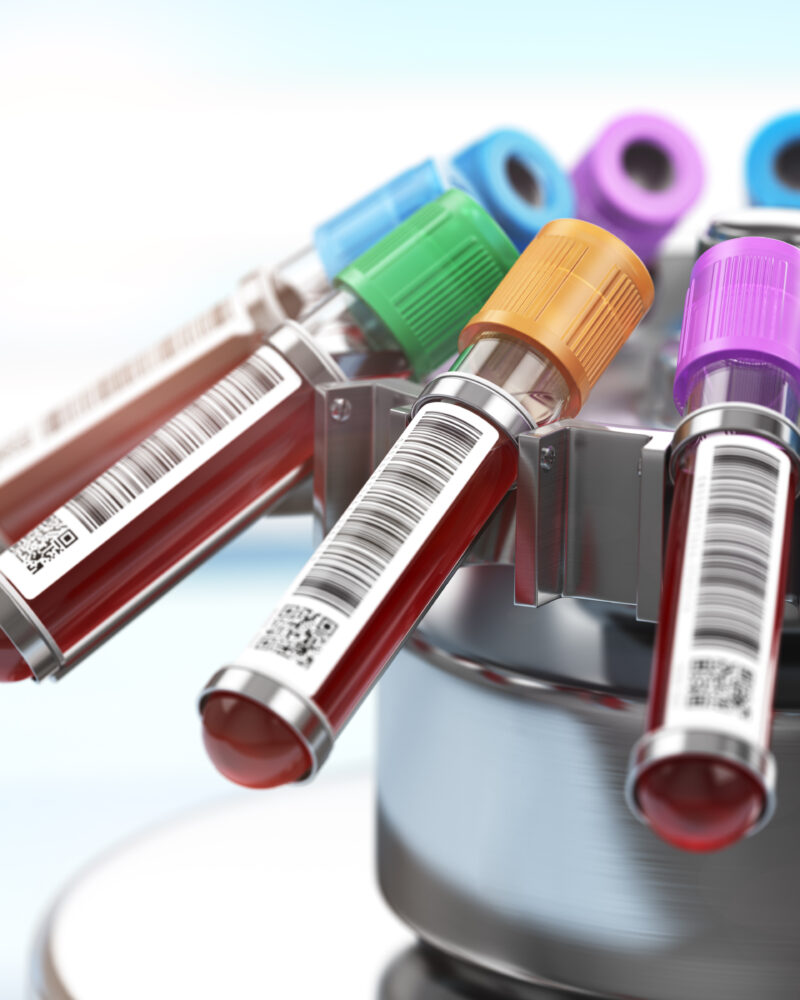 Organovo (ONVO) is a Smart Long-Term Investment • BioTech Health X