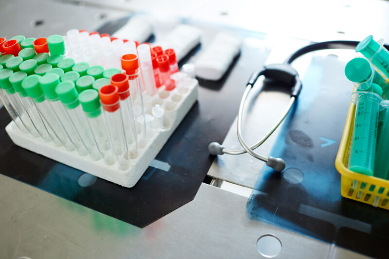 Why EDAP TMS (EDAP) Could Be the Next $2B MedTech Breakout • BioTech ...